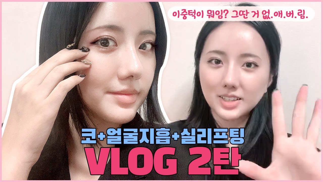 성형vlog 복코성형얼굴지흡실리프팅 한달차 인터뷰😆 3개월차 후기까지👌 코성형후기코성형전후성형 브이로그복코성형