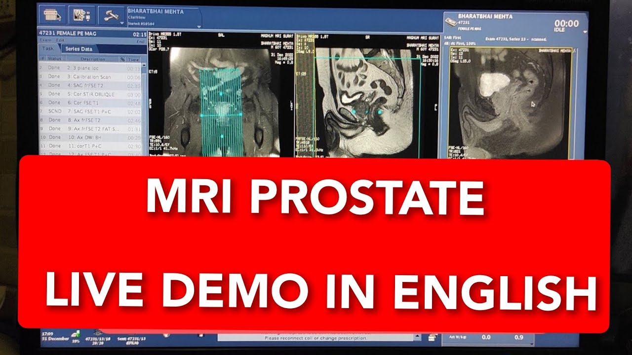 Prostate MRI scan protocol, positioning and planning | Live Demo in ...