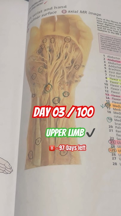 Day 03 / 100 🎯#100dayschallenge #upperlimb completed ☑️ #mrcs #selfmotivation #shorts #doctor ...