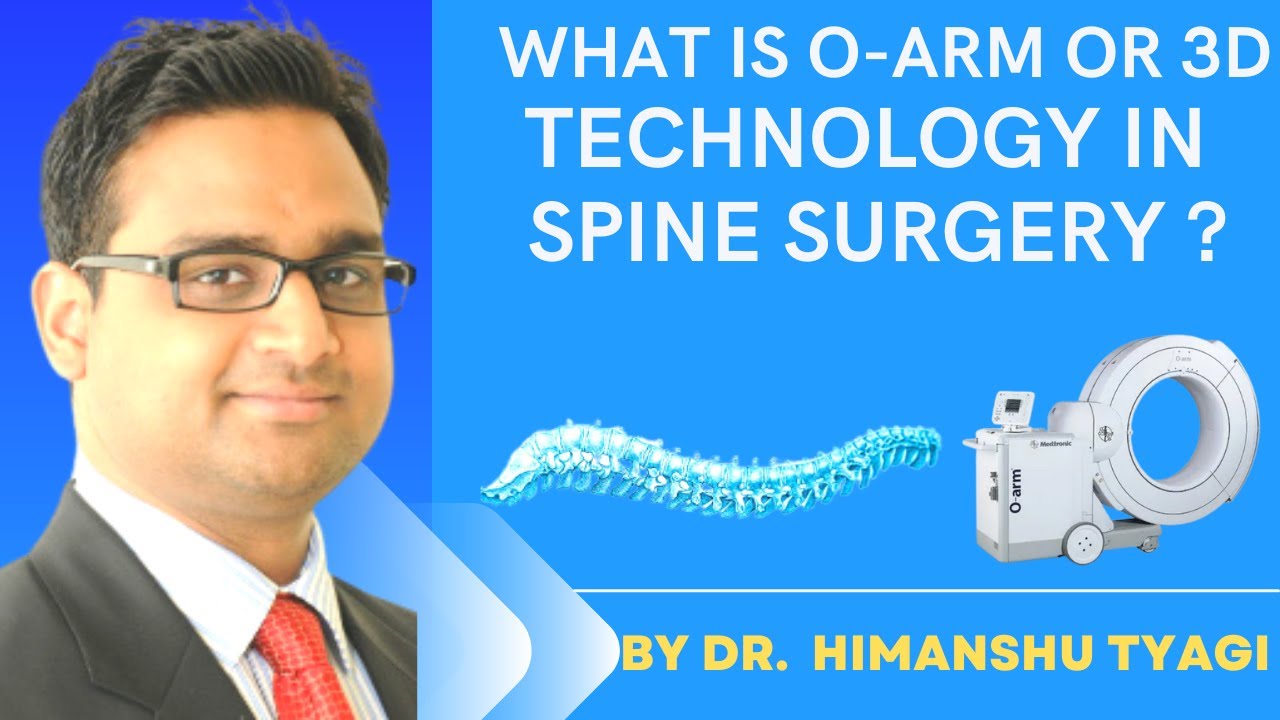 What Is O-ARM Or 3D Technology In Spine Surgery ? - YouTube