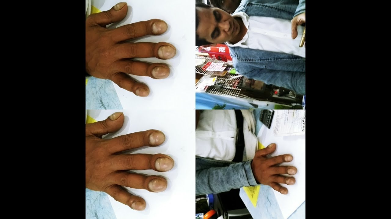 alien real finger - YouTube