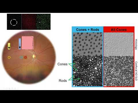 Eye Care Beyond Black and White: Color Vision Changes in Macular ...