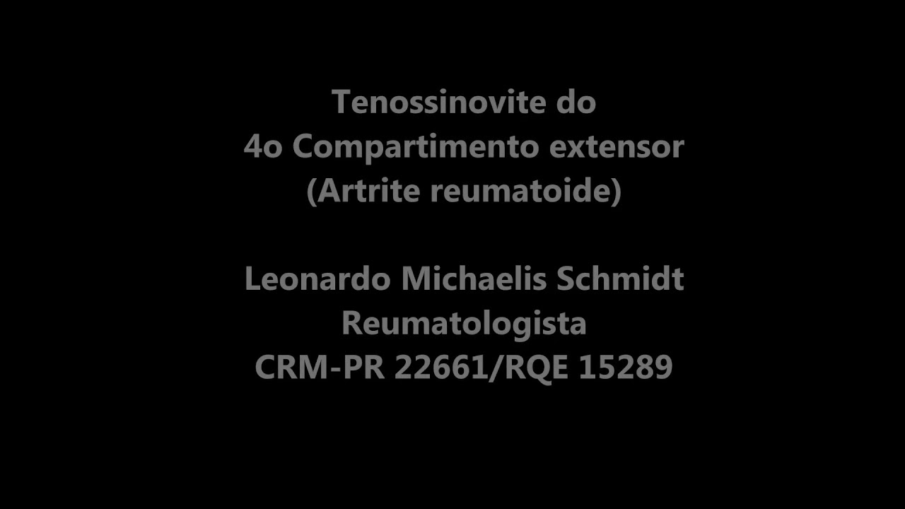 Tenossinovite do 4o compartimento extensor do carpo 🔥 - YouTube
