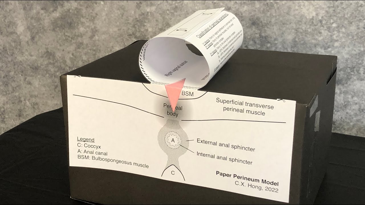 The Paper Perineum Model: An Accessible Three-Dimensional Model for ...