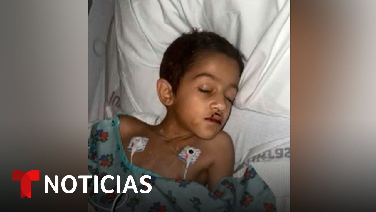 Se recupera el niño golpeado por un dron | Noticias Telemundo - YouTube