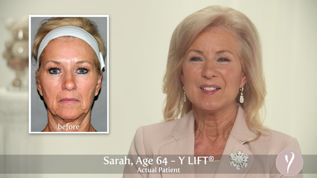 Y LIFT ® 2013 - Sarah | Instant, Non Surgical Facelift - YouTube