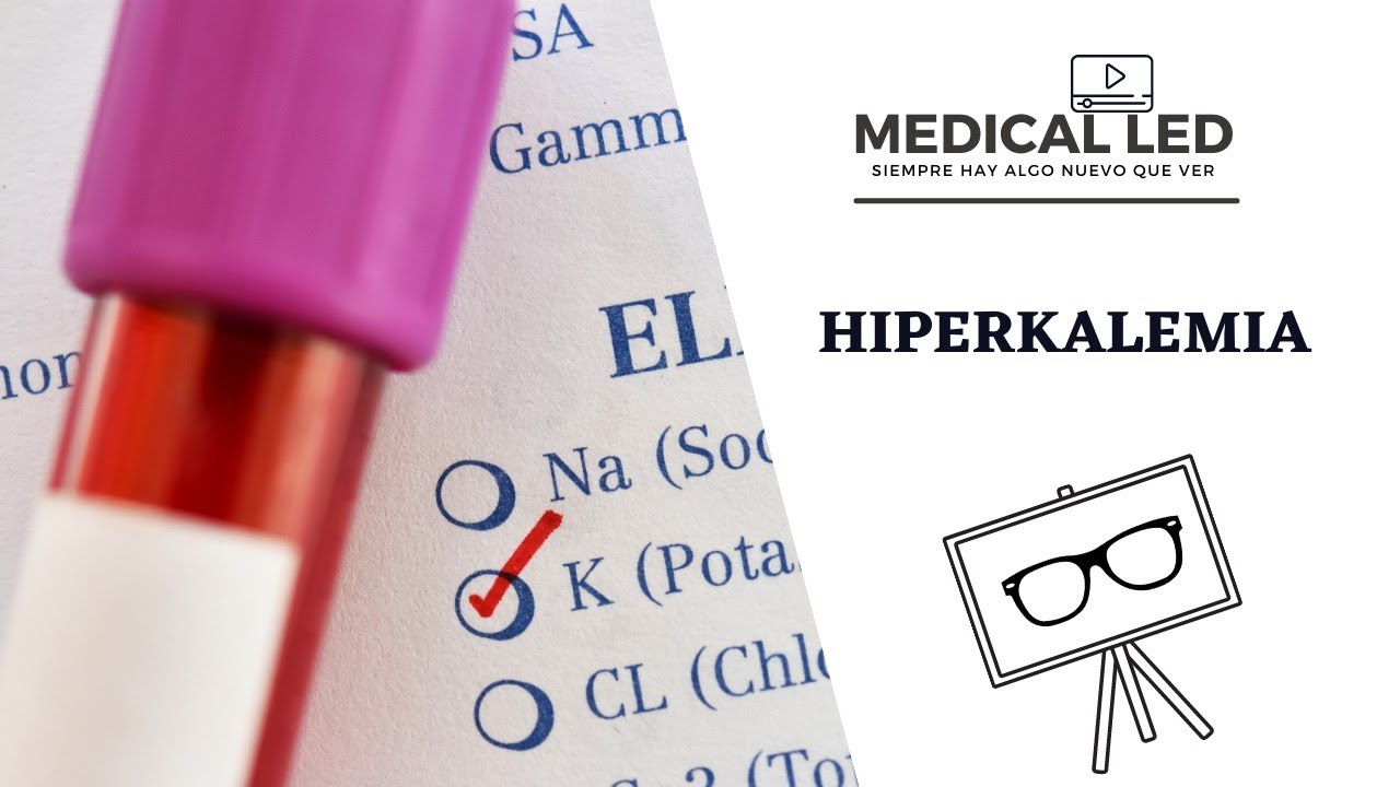 HIPERKALEMIA 1: Definición y clasificación - YouTube