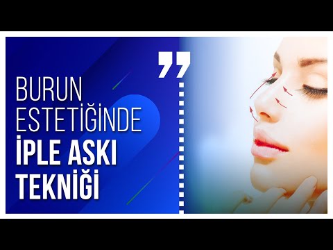 Burun estetiğinde iple askı tekniği