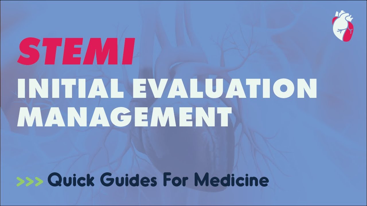 STEMI Initial Evaluation and Management | Quick Guides For Medicine ...