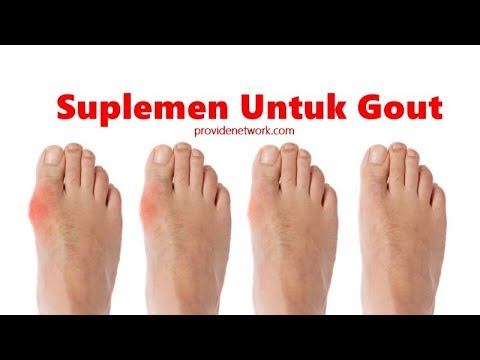 Suplemen Untuk Gout | Cara Merawat Gout Tanpa Ubat - YouTube
