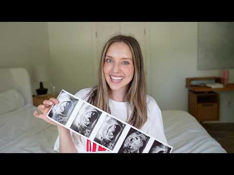 I'M PREGNANT! 1st Trimester Update