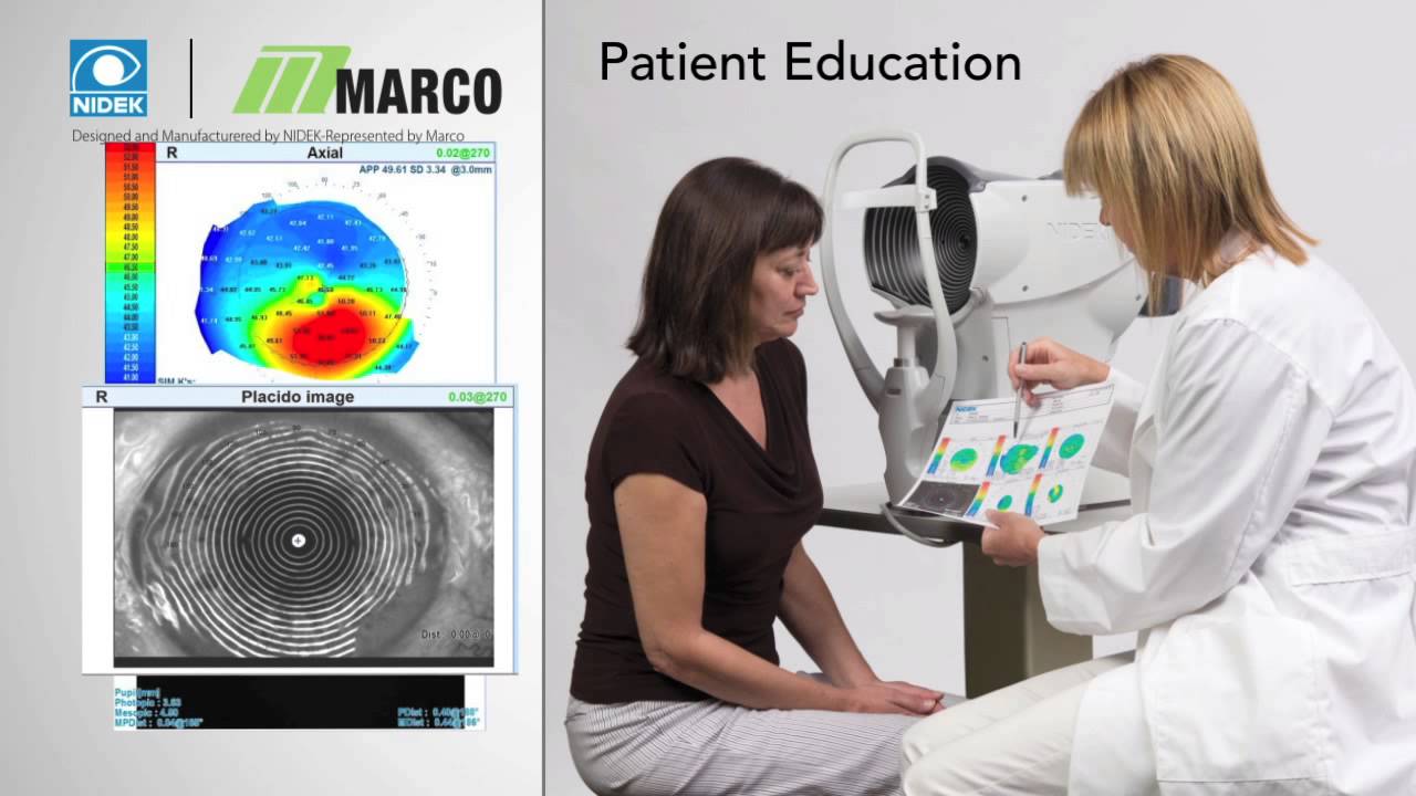 OPD-Scan III: Benefits for Optometry - YouTube