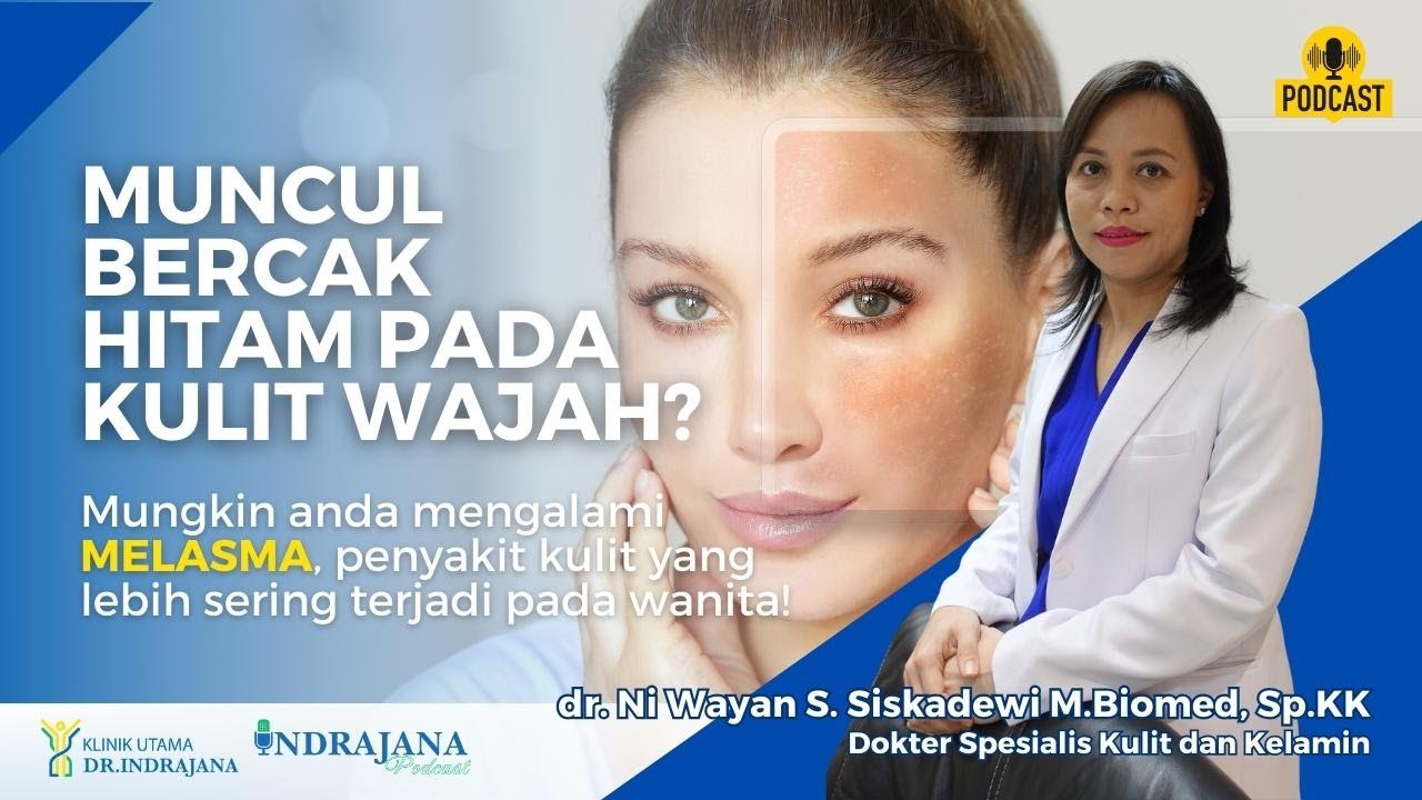Melasma : Bercak hitam pada kulit yang mengganggu kepercayaan diri ...
