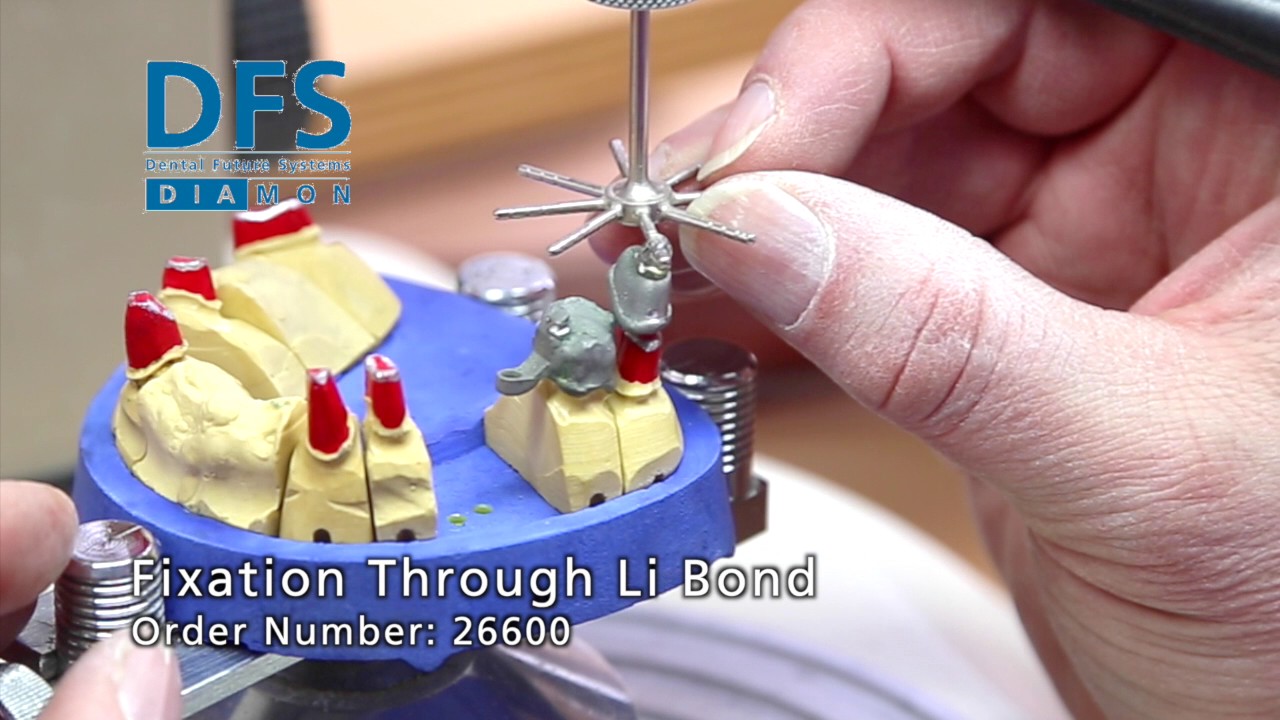 Fixation Through Li Bond - YouTube