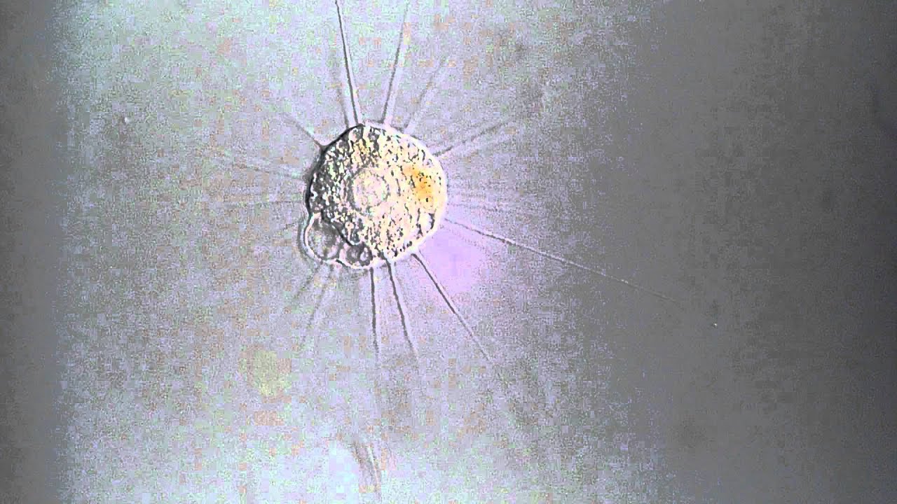Heliozoa amoeboid - YouTube
