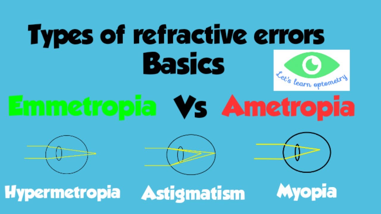 Emmetropia & Ametropia/ Different types of refractive errors/Myopia ...