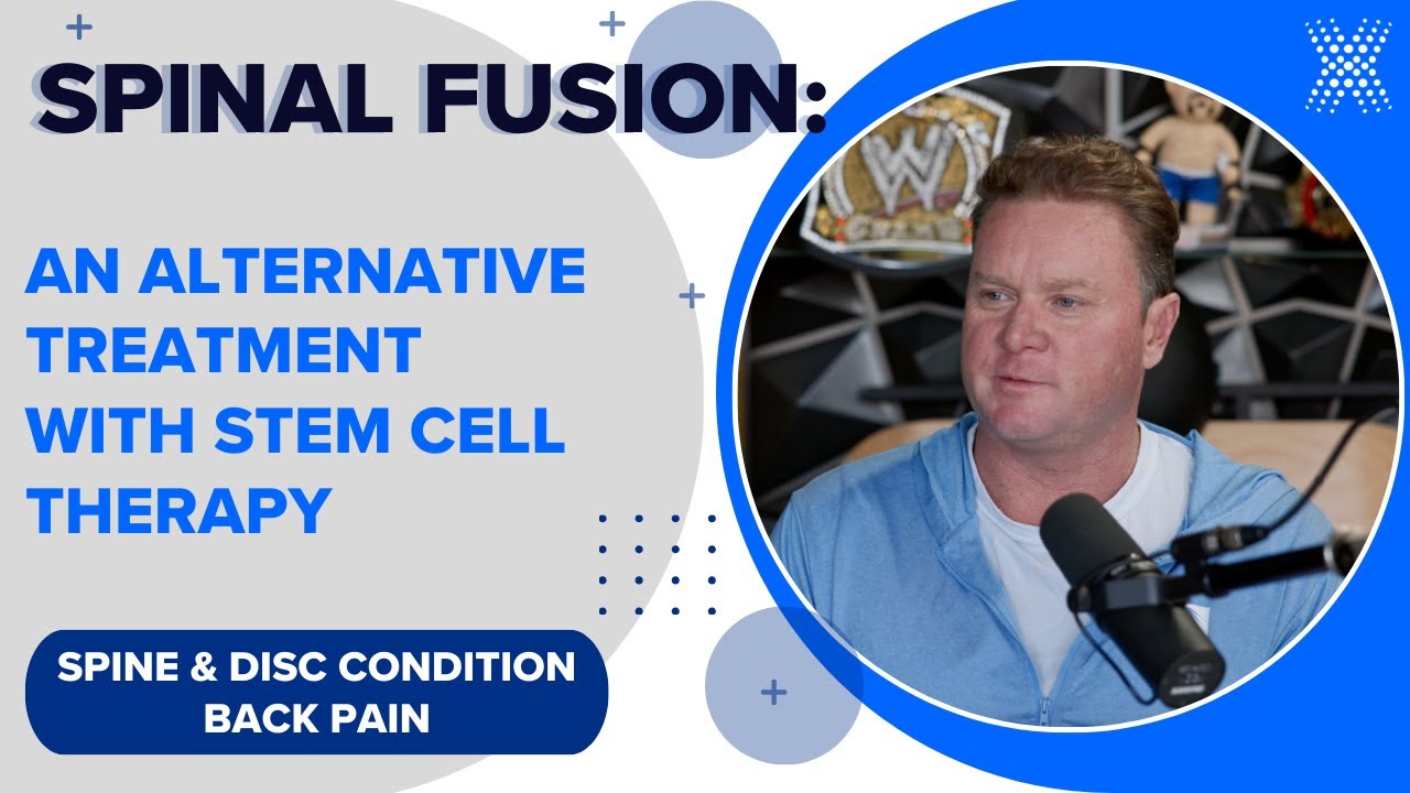 Innovative Treatments Revealed: Alternative to Spinal Fusion - YouTube