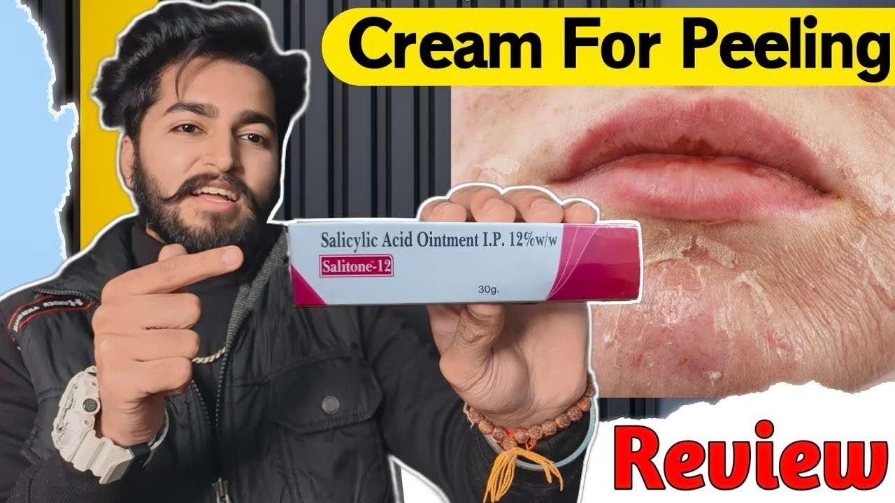 Skin Peeling Ointment Salicylic Acid 12% Cream | Salitone 12 Cream ...