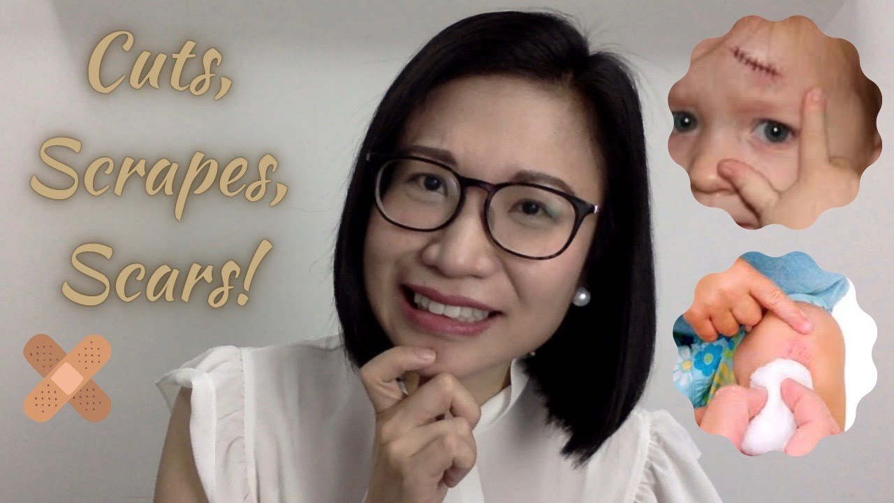 Cuts, Scrapes and Scars in Kids: How to Make Wounds Heal Properly | Dr ...