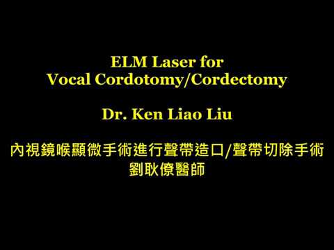 ELM Laser for Vocal Cordotomy/ Cordectomy 內視鏡喉顯微手術進行聲帶造口/聲帶切除手術 - YouTube
