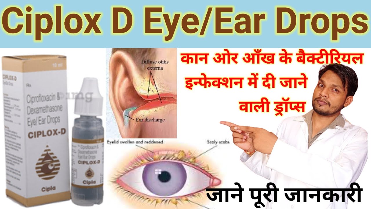 Ciplox-d Eye/Ear drops | Ciprofloxacin dexamethasone eye ear drops ...
