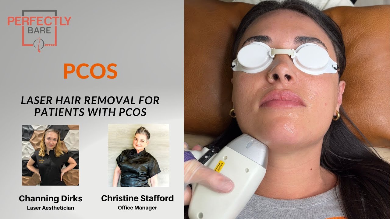 PCOS and Laser Hair Removal - An indepth discussion at Perfectly Bare ...