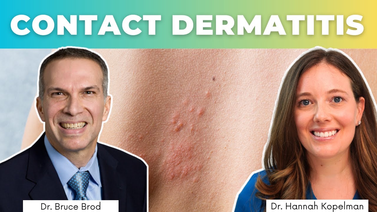 Treating Contact Dermatitis | Dr. Bruce Brod - YouTube