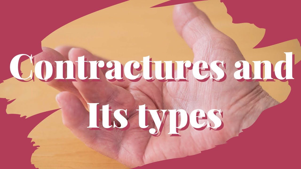 Contractures and types of contractures/ Therapeutics - YouTube