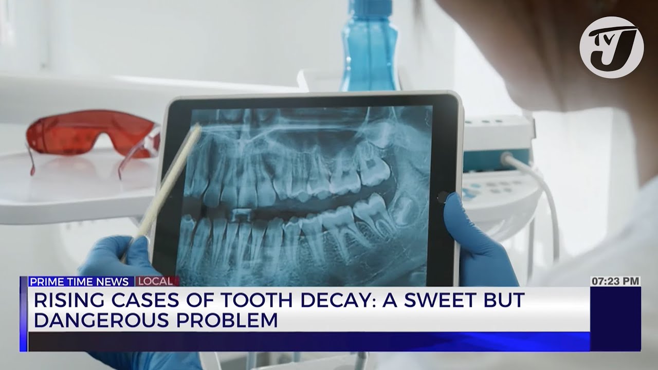 Rising Cases of Tooth Decay: A Sweet but Dangerous Problem | TVJ News ...