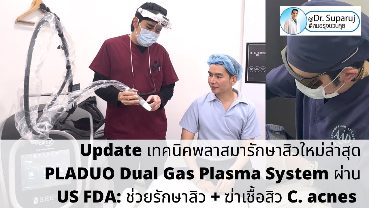 เทคนิคพลาสมารักษาสิวใหม่ล่าสุด PLADUO Plasma System @HappyNucha - YouTube