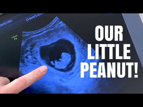 FIRST LOOK AT OUR LITTLE PEANUT! - YouTube