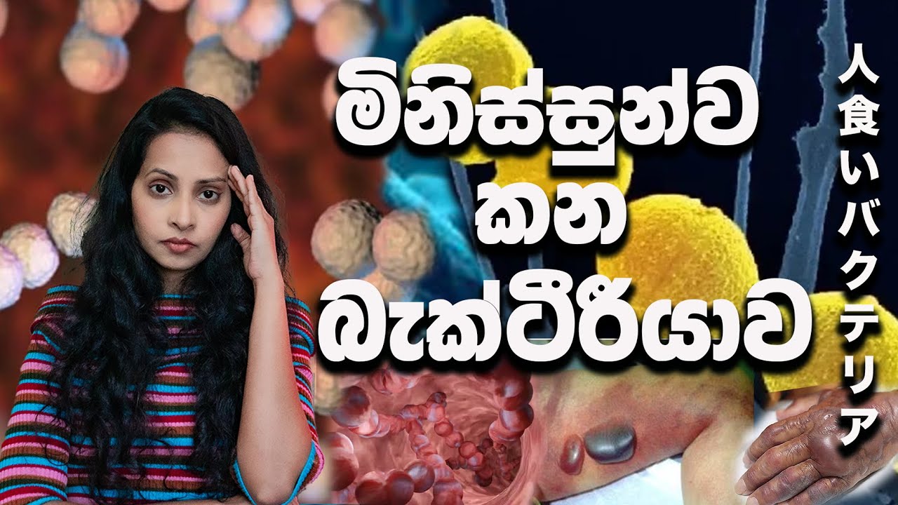 ජපානයේ පැතිරයන මාරාන්තික බැක්ටීරියාව ඇත්තක් ද? | NEW BACTERIA IN JAPAN ...