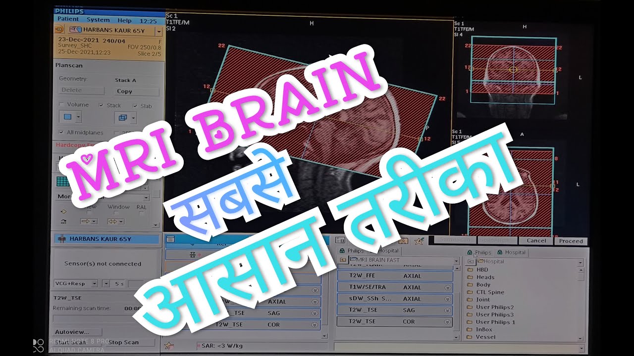 How to do MRI BRAIN in simple way 1.5 TESLA PHILIPS machine - YouTube