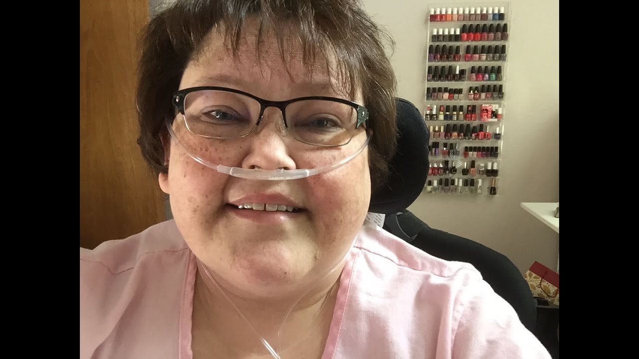 Lupus 1-18-15 Moments... Surgery and Anesthesia - YouTube