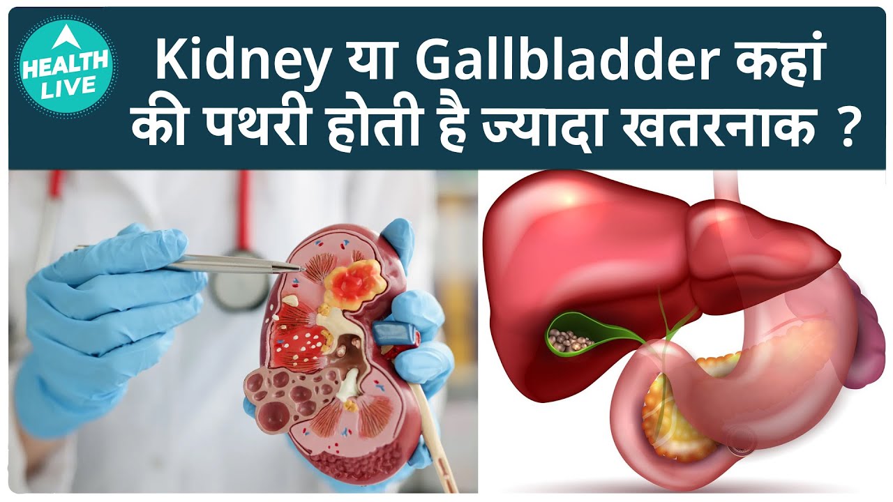 Kidney या Gallbladder? क्या होता है खतरनाक? | Kidney Stone | Health ...