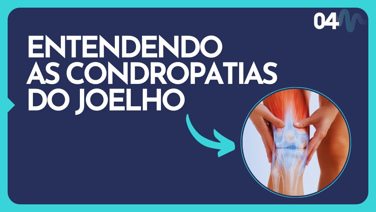 Entendendo as condropatias do joelho - YouTube