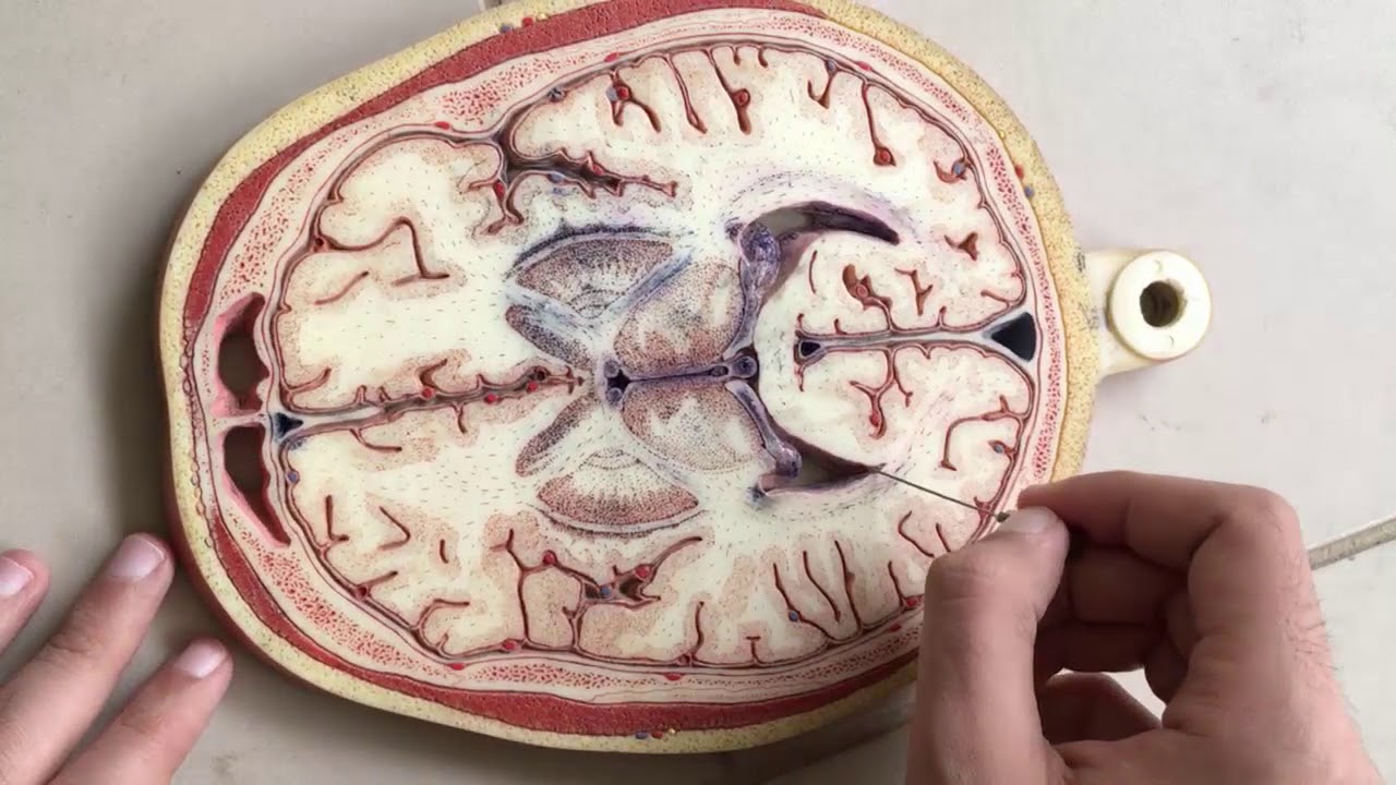 Cross sections of the brain - YouTube