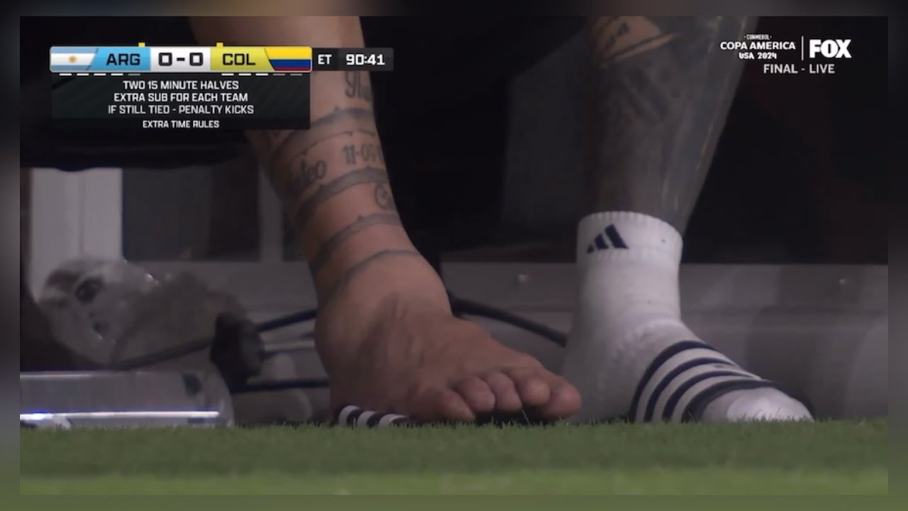Messi’s swollen ankle after getting injured at the Copa America - YouTube