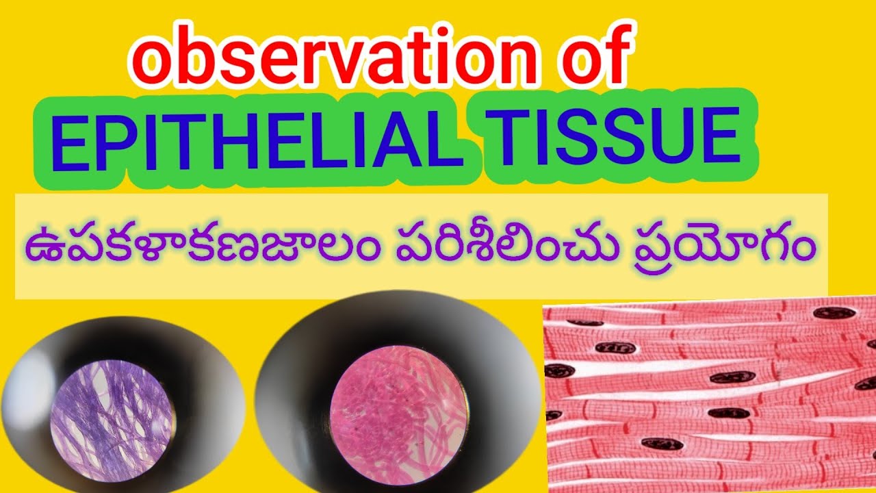 OBSERVATION OF EPITHELIAL TISSUE /ఉపకళా కణజాలం పరిశీలించుట - YouTube