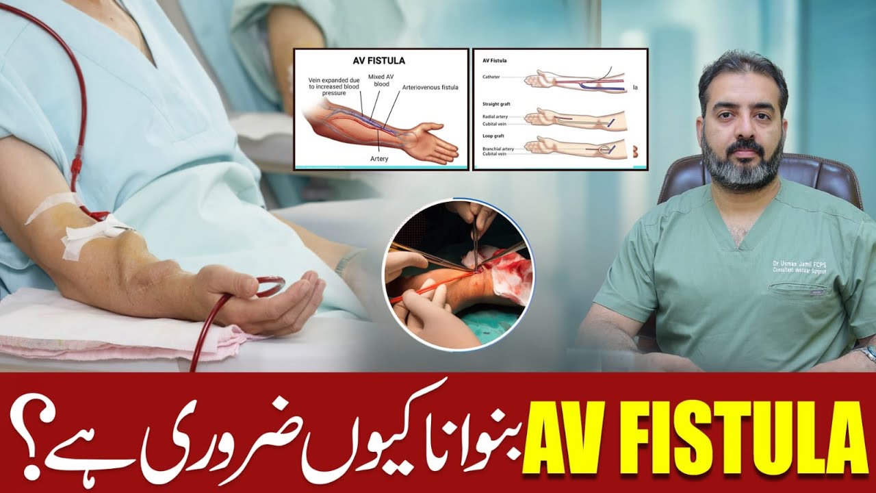 Why Is AV Fistula Important for Dialysis Patients? - YouTube
