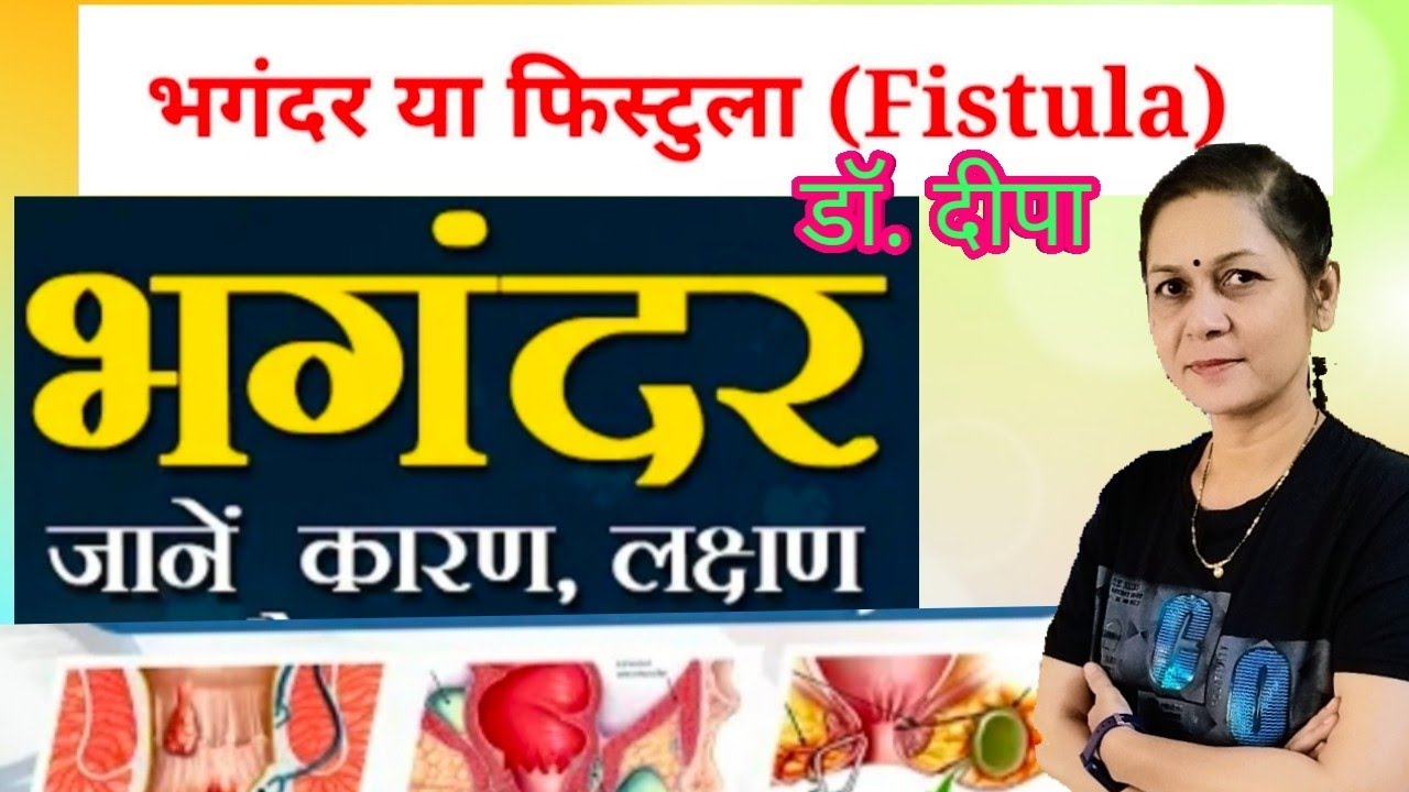 Fistula Causes And Symptoms | Bhagandar Ke Karan Aur Lakshan | Dr ...