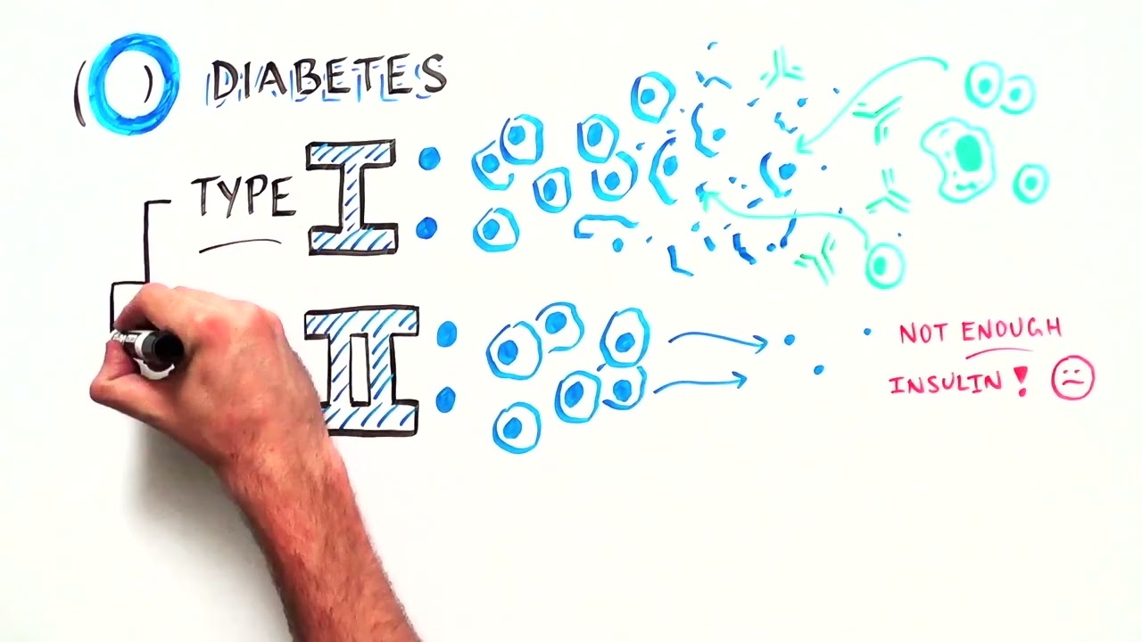 How to be diabetes smart - YouTube
