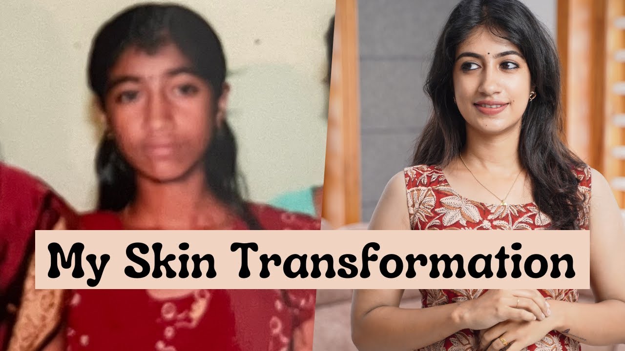 My Skin Transformation Journey | Skin Brightening | എന്റെ skin tone ഞാ ...