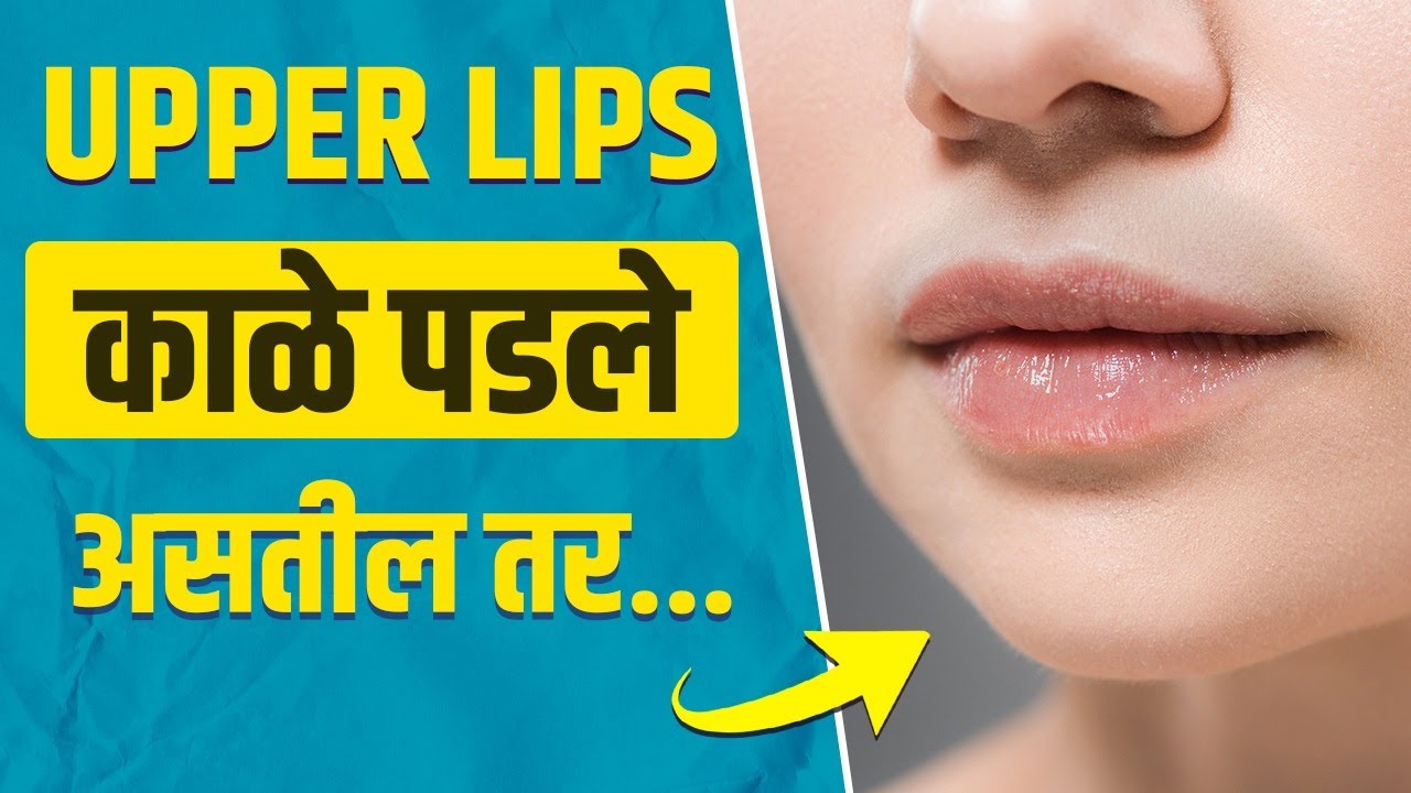 Upper lips खूप काळे पडलेत का? | How to Lighten Dark Upper Lip | Dark ...