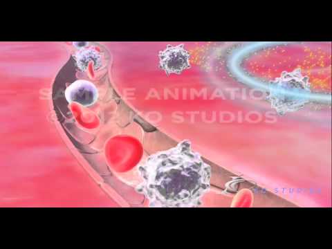 Pulse Radio-Frequency Mechanism of Action - YouTube