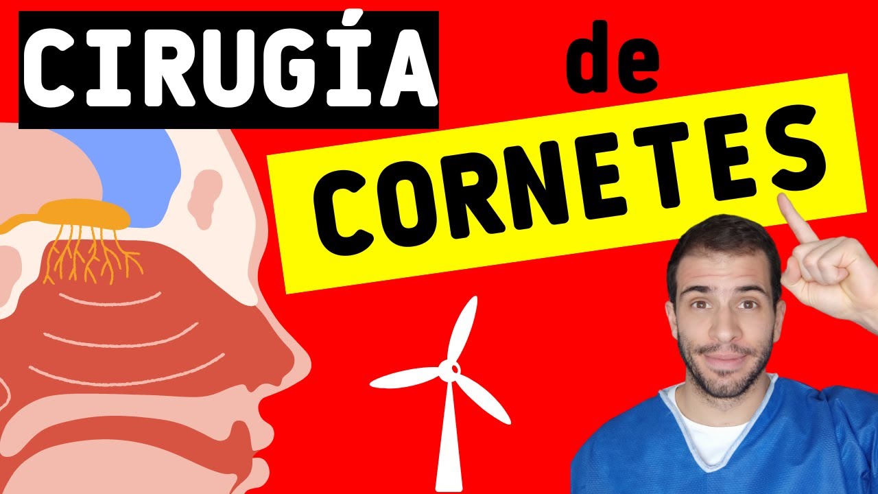 TURBINOPLASTIA. Riesgos, complicaciones y postoperatorio de la CIRUGÍA ...