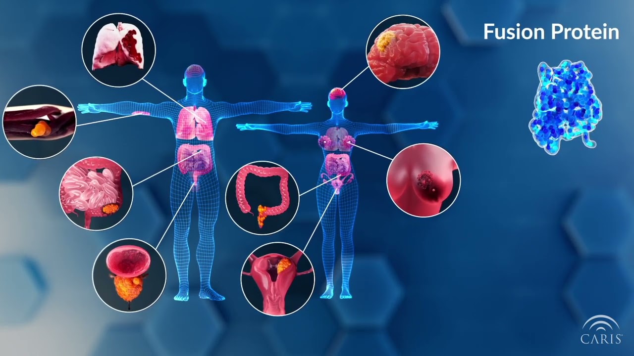 What is Gene Fusion? - YouTube