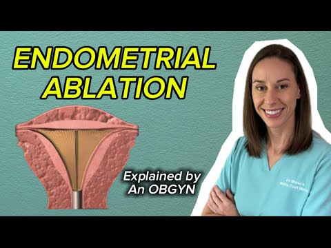 Endometrial Ablation: OBGYN Shares EVERYTHING You Need To Know - YouTube