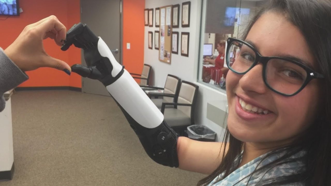 "Hero" Arm Opens World Of Possibilities - YouTube