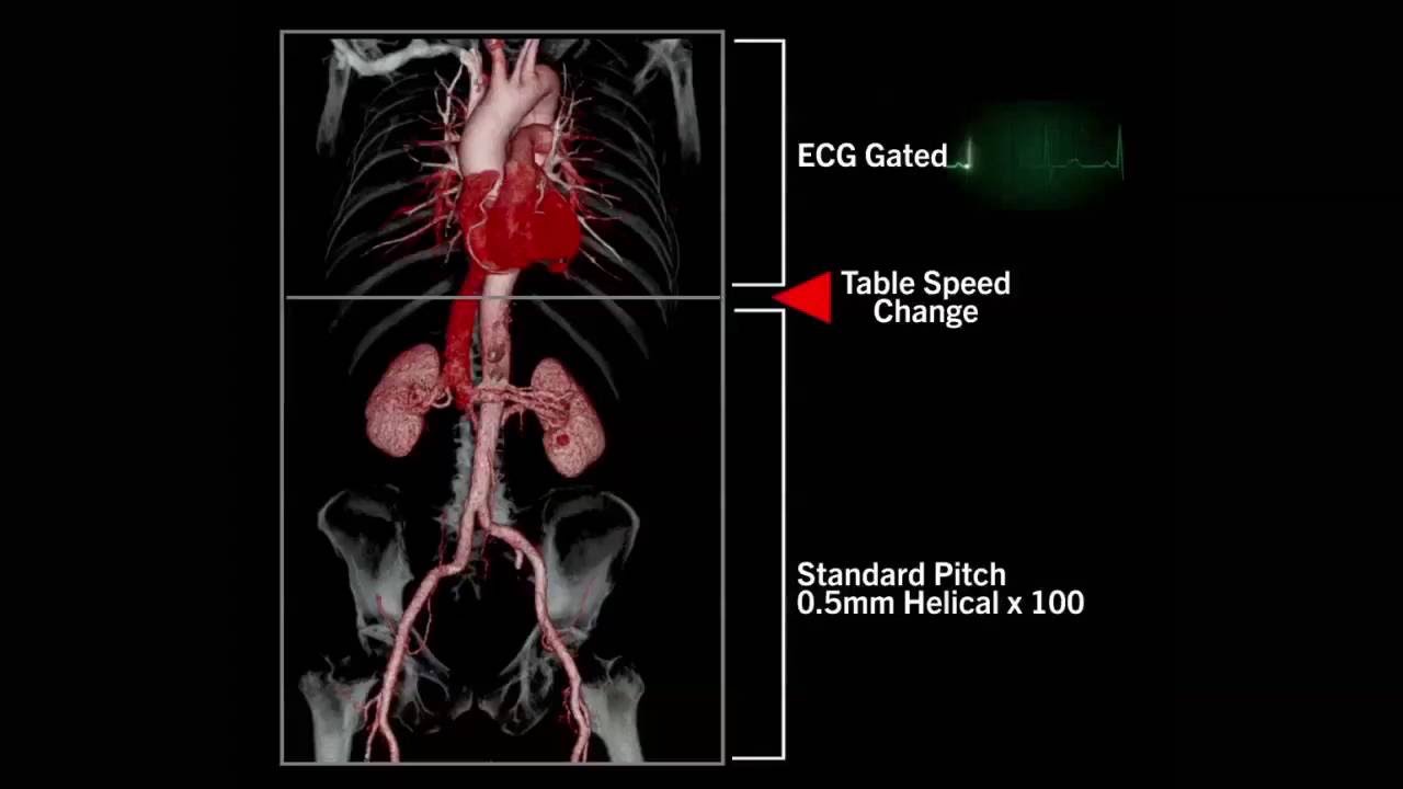 Adaptive Diagnostics vHP - YouTube
